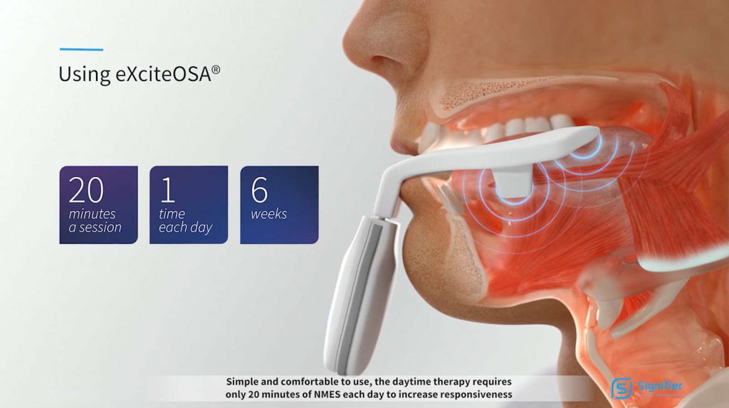 eXciteOSA UK - How eXciteOSA® can help your sleep