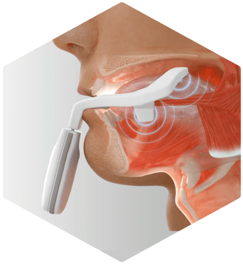 How It Works - eXciteOSA UK